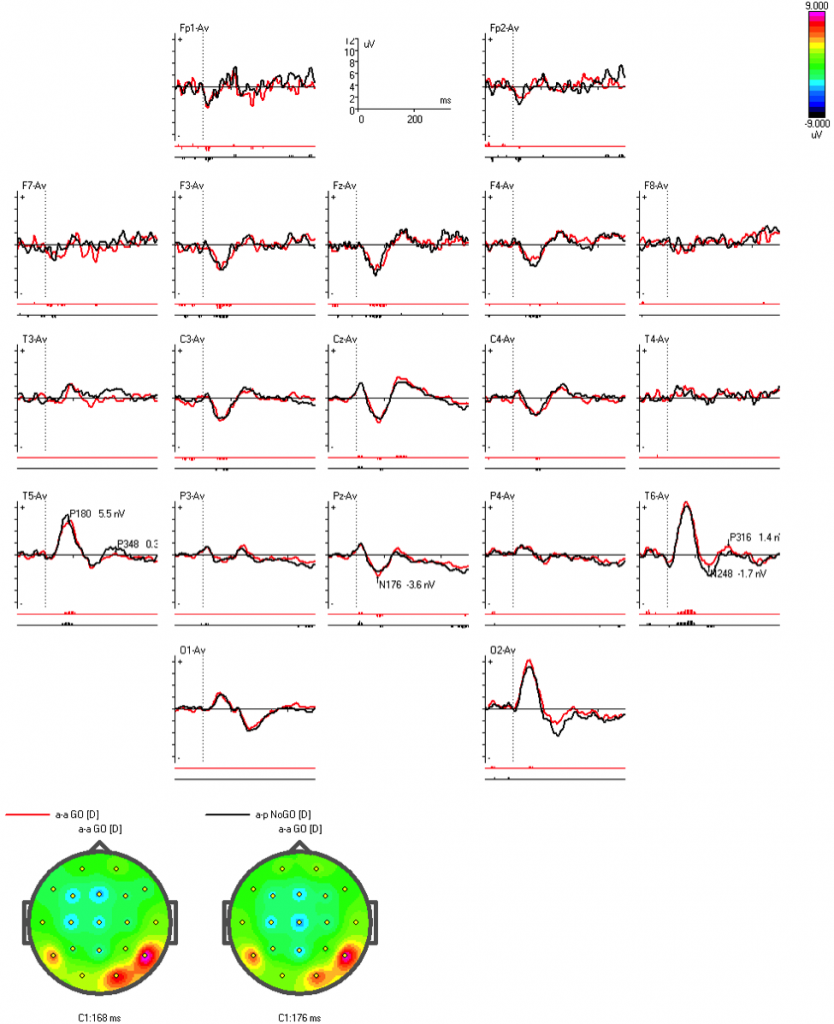 QEEG Brain Mapping - Restore Behavioral Health