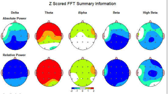 QEEG Brain Mapping - Restore Behavioral Health